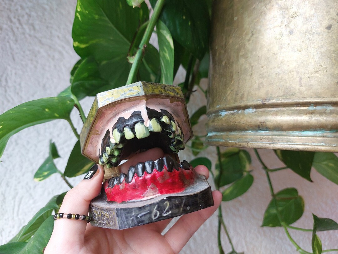 My Gums Are Bleeding Movable Tooth Model - Etsy