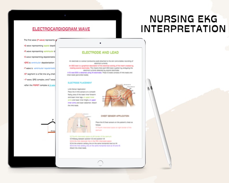 EKG Interpretation Nursing Study Guide – Cardiac Rhythms (digital ...
