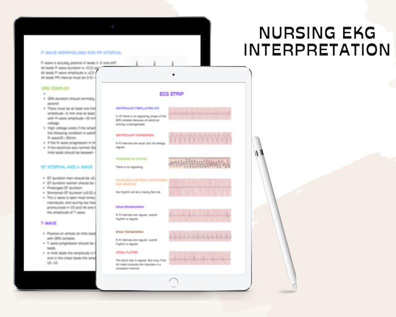 Ekg Interpretation Study Guide - Cardiac Rhythms Nursing Notes ...