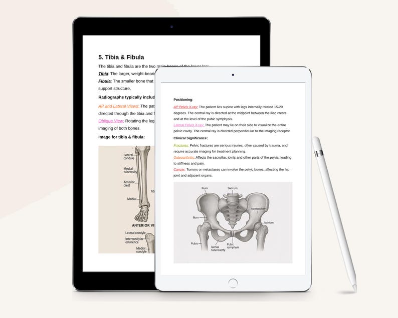 Comprehensive X-ray Positioning Study Guide, Digital Download Study ...