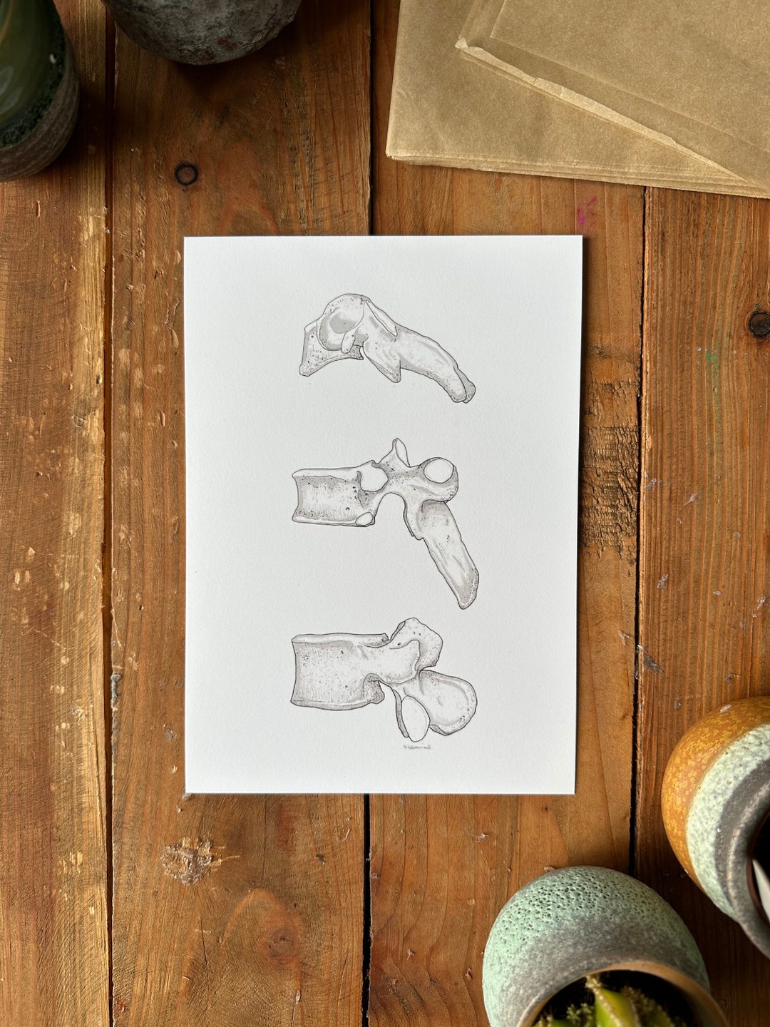 Vertebrae Trio Anatomy Print, Anatomy Poster, Wall Art, Medical Drawing ...
