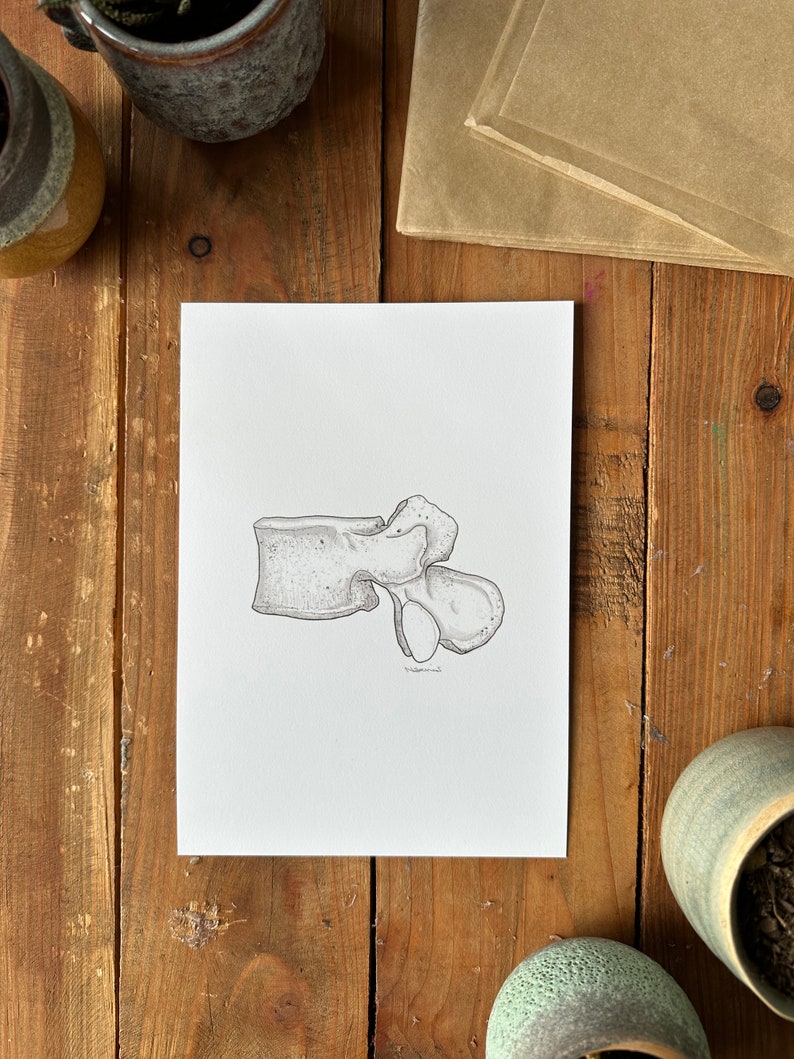 Lumbar Vertebrae Anatomy Print, Anatomy Poster, Wall Art, Medical ...