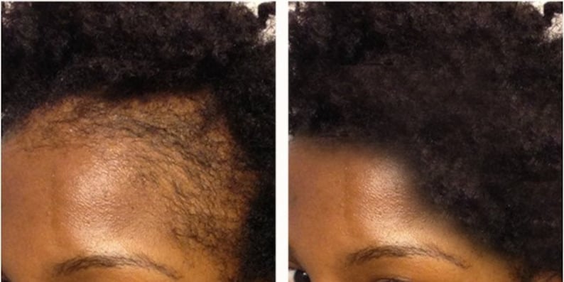 Ginger and Chembe Hair Fertilizer - Etsy