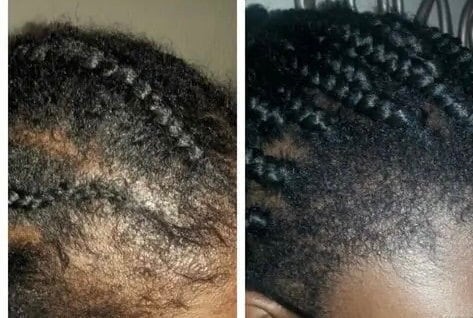 African Wild Rosemary and Mint Hair Extra Strong Booster Oil - Etsy