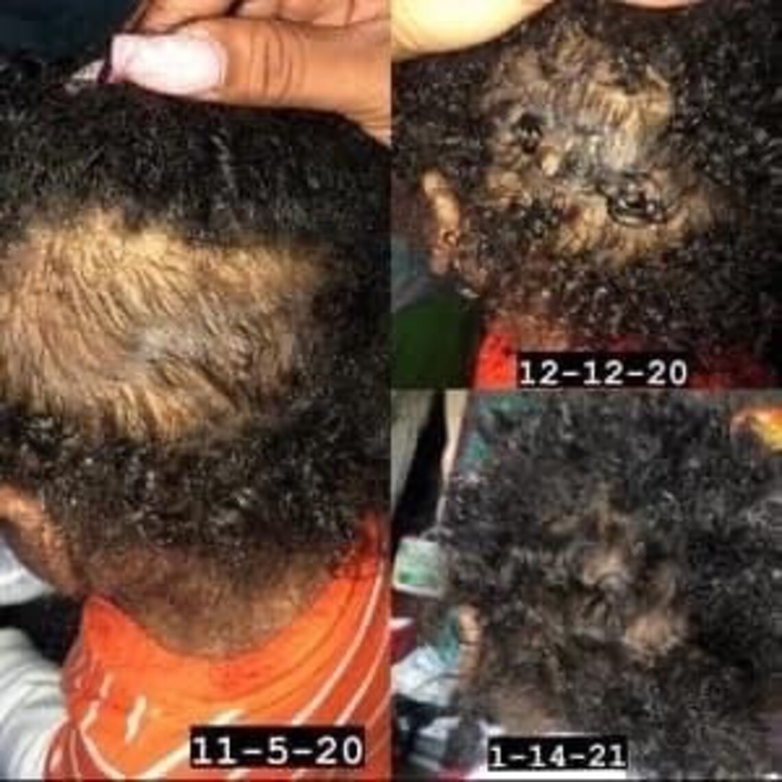 Superior Growth Grease, All Natural Hair Grease,aloe Vera Hair Grease ...