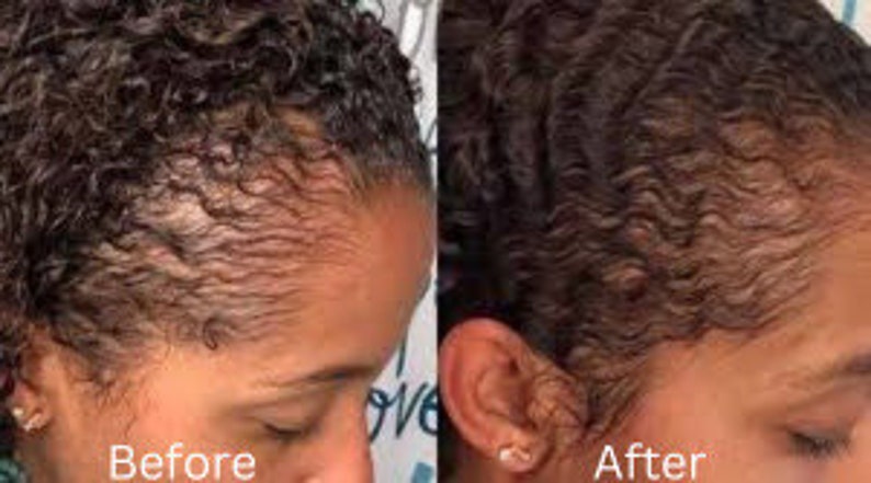 Superior Growth Grease, All Natural Hair Grease,aloe Vera Hair Grease ...