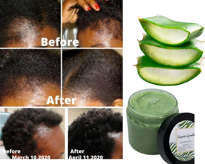 Superior Growth Grease, All Natural Hair Grease,aloe Vera Hair Grease ...