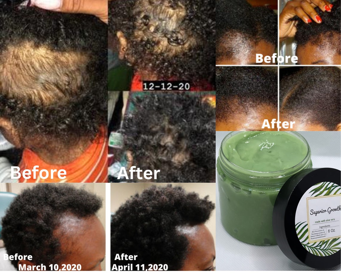 Superior Growth Grease, All Natural Hair Grease,aloe Vera Hair Grease ...