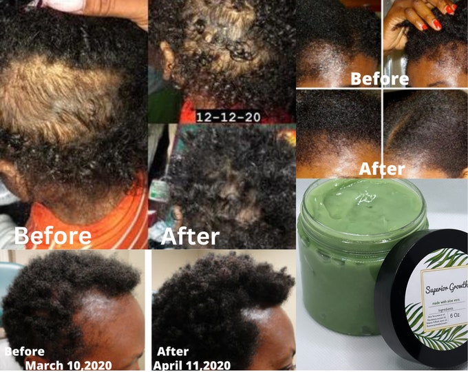 Superior Growth Grease, All Natural Hair Grease,aloe Vera Hair Grease ...