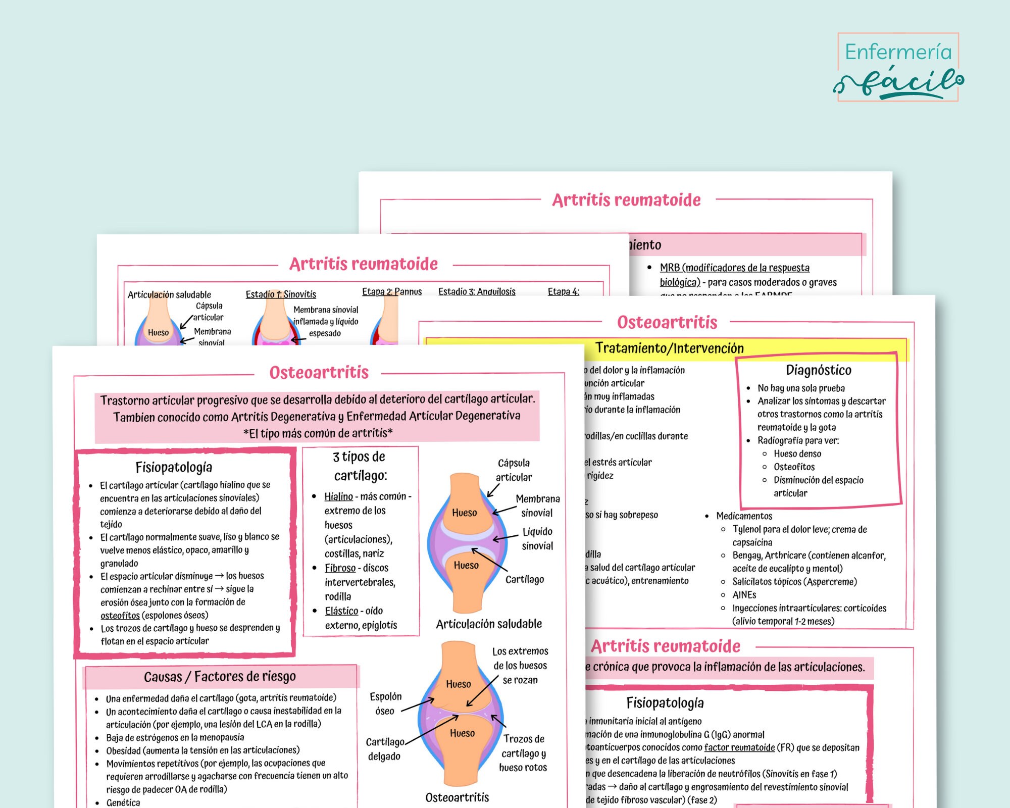 Osteoarthritis and Rheumatoid Arthritis Study Guide Nursing Study ...