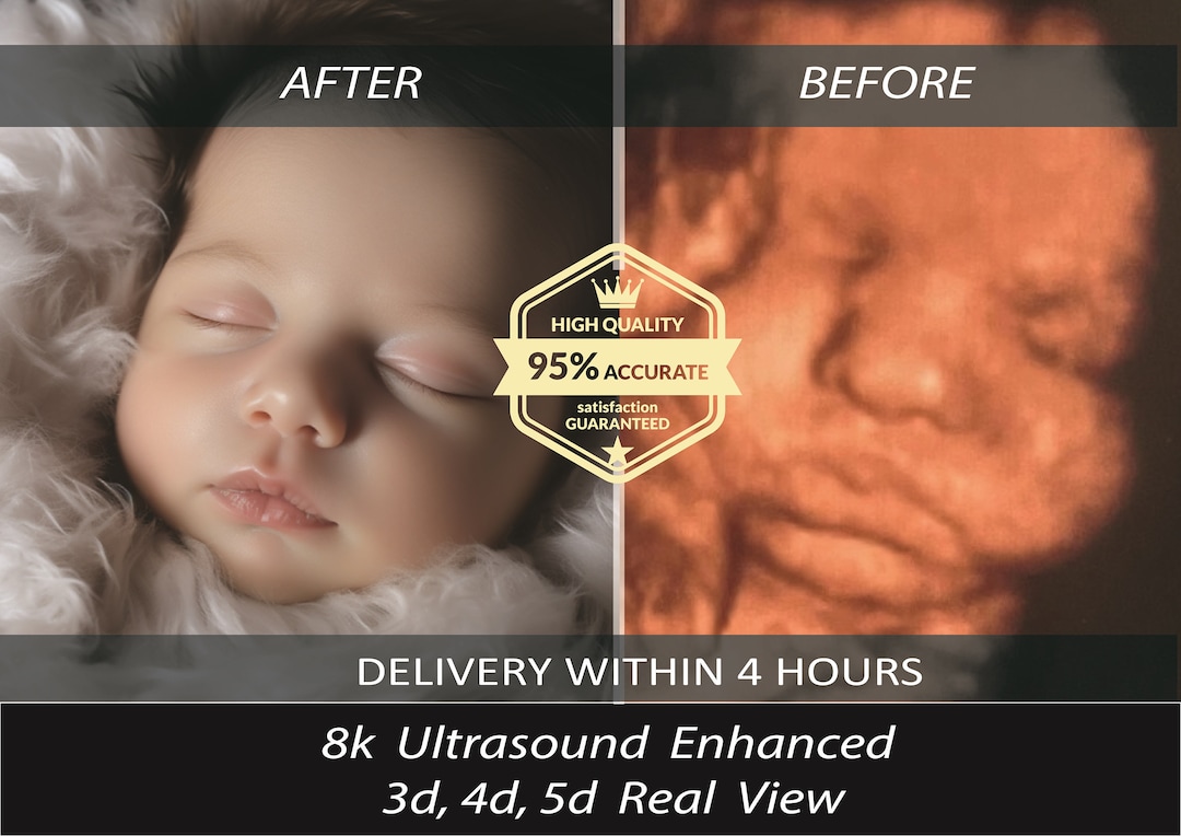 3D, 4D, 5D and HD Ultrasound, Ultrasound Baby, Real View, Ultrasound ...