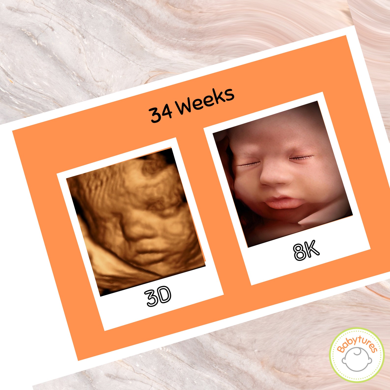 8K Ultrasound Turn 3D/5D/HD Ultrasounds Into 8K Images - Etsy