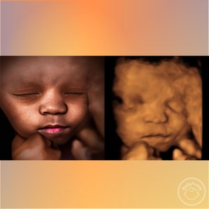 8K Ultrasound | Turn 3D/5D/HD Ultrasounds Into an 8K Image - Etsy