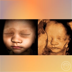 8K Ultrasound | Turn 3D/5D/HD Ultrasounds Into an 8K Image - Etsy