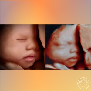 8K Ultrasound | Turn 3D/5D/HD Ultrasounds Into an 8K Image - Etsy