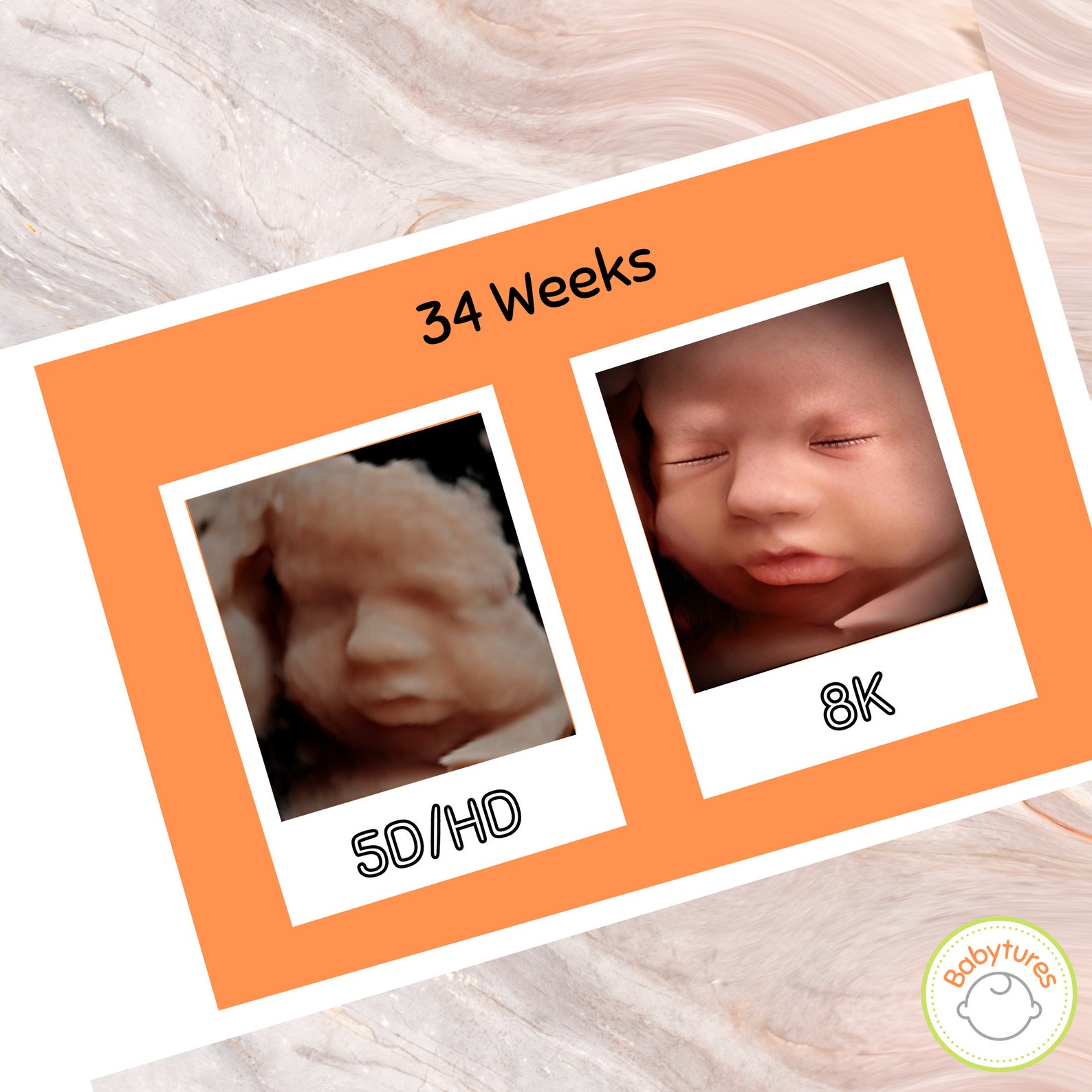 8K Ultrasound Turn 3D/5D/HD Ultrasounds Into 8K Images - Etsy