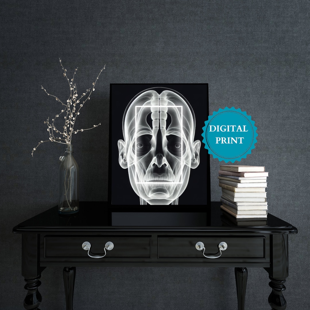 SLP Gift, Speech Therapy, Speech Language Pathologist ,giftx-ray Photo ...