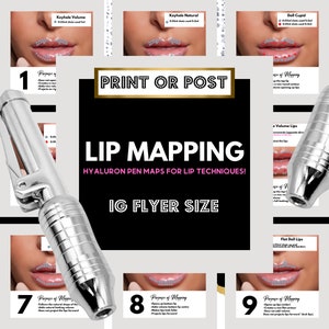 Hyaluron Pen Lip Maps, Lip Mapping Guides, Techniques, Russian Lips ...