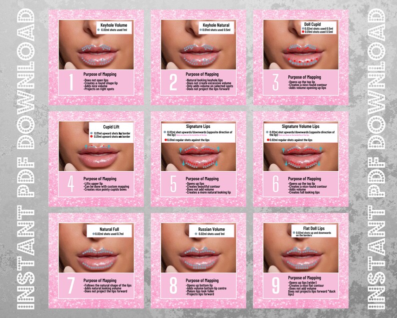 Hyaluron Pen Lip Maps, Lip Mapping Guides, Techniques, Russian Lips ...