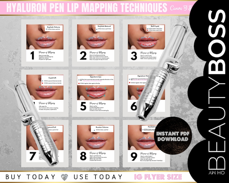Hyaluron Pen Lip Maps, Lip Mapping Guides, Techniques, Russian Lips ...