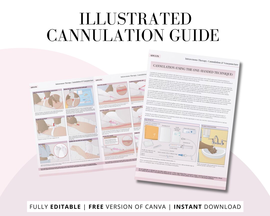 Illustrated Step by Step Cannulation Guide, One Hand Technique, Handout ...