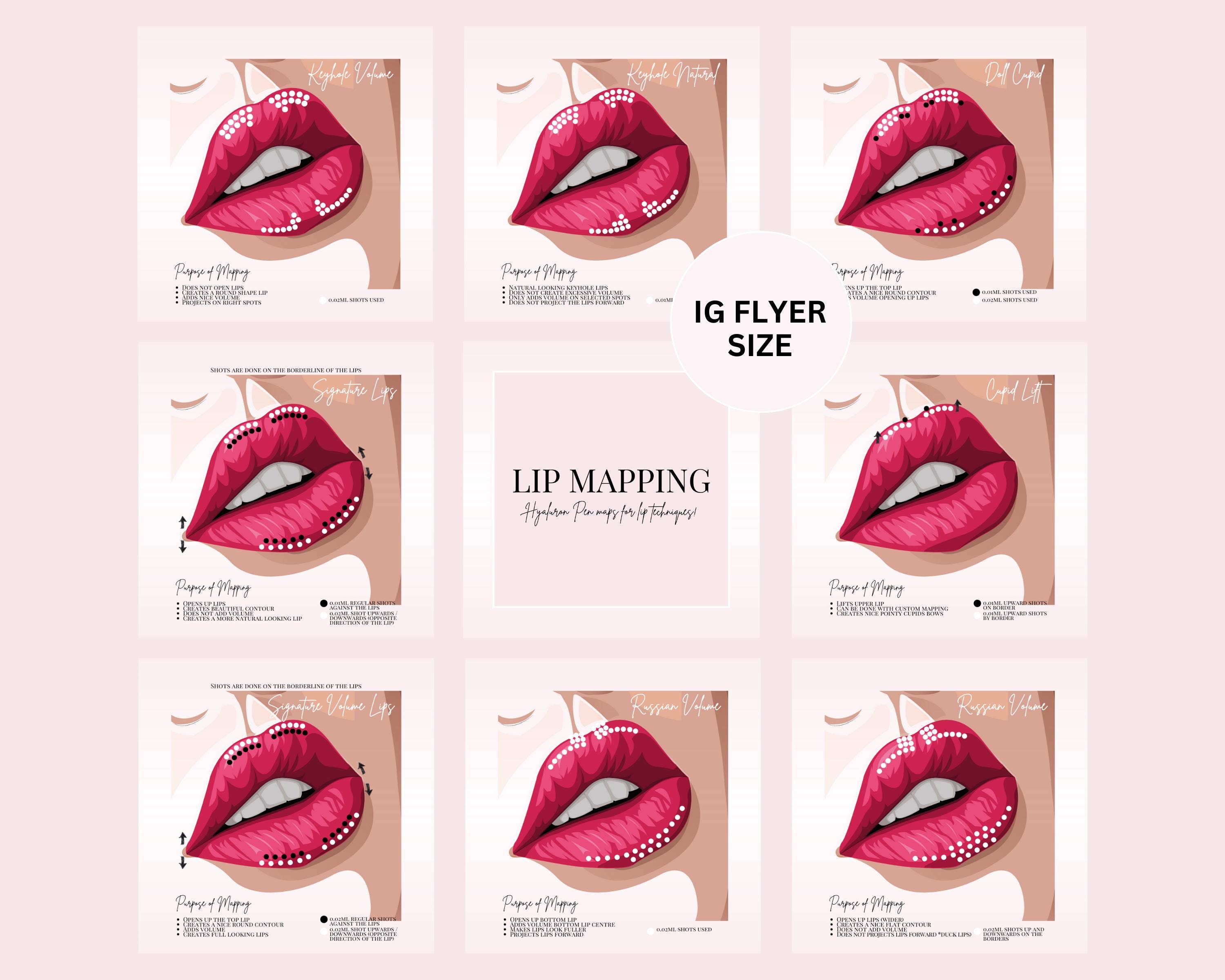 Hyaluron Pen Lip Mapping Guides, Lip Map Techniques, Russian Lips ...