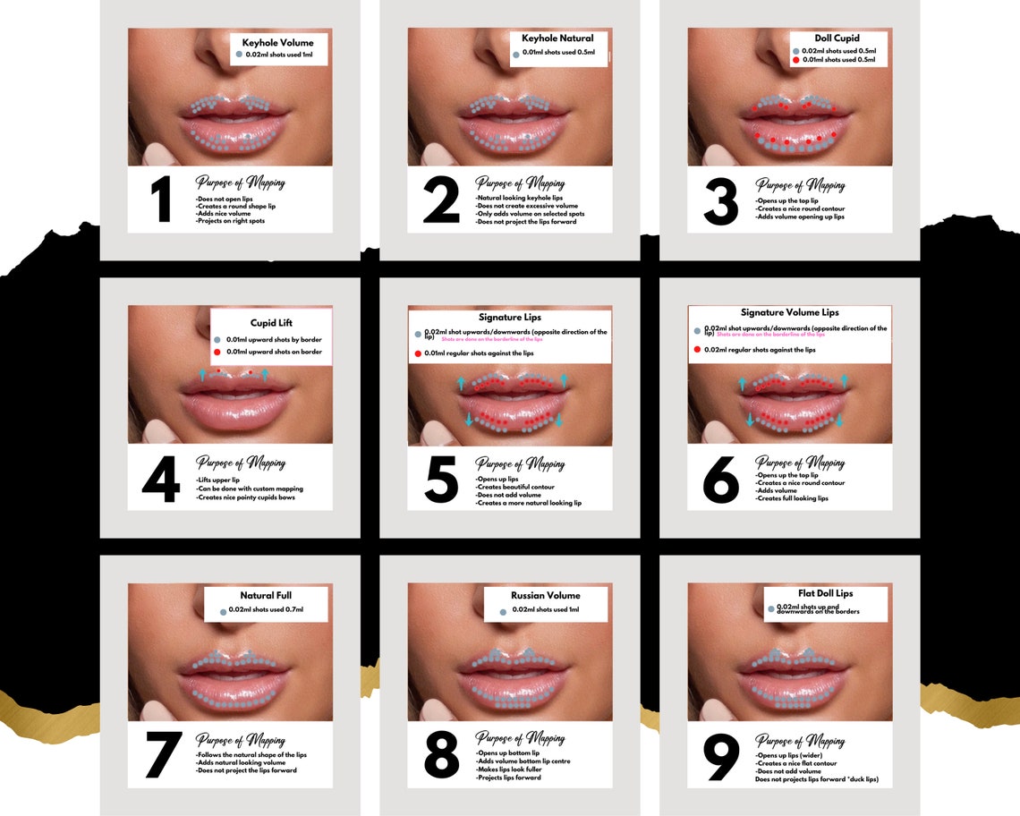 Hyaluron Pen Lip Maps, Lip Mapping Guides, Techniques, Russian Lips ...