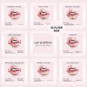Hyaluron Pen Lip Mapping Guides, Lip Map Techniques, Russian Lips ...