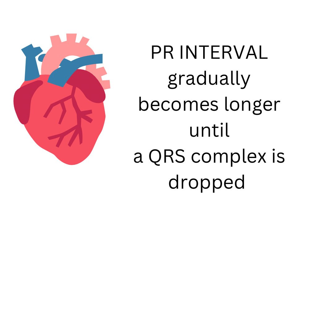 CCRN Cardiac Notes & Questions Digital File Instant Download 149 Pages ...