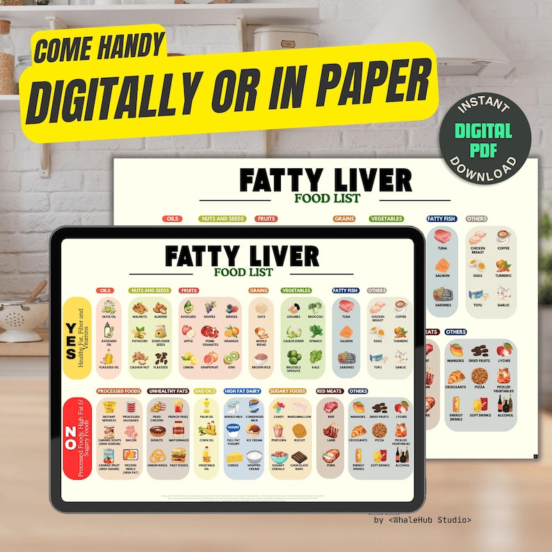 Fatty Liver Grocery Food List, Food Chart Fatty Liver Poster ...