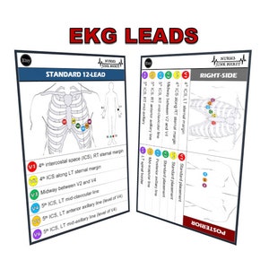 Badge Buddy - EKG Leads - Etsy