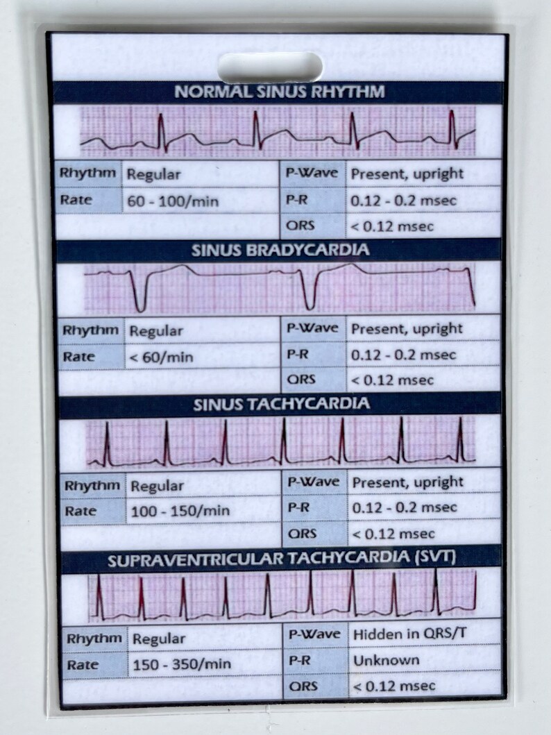 EKG Interpretation Digital Download Badge Buddy - Etsy