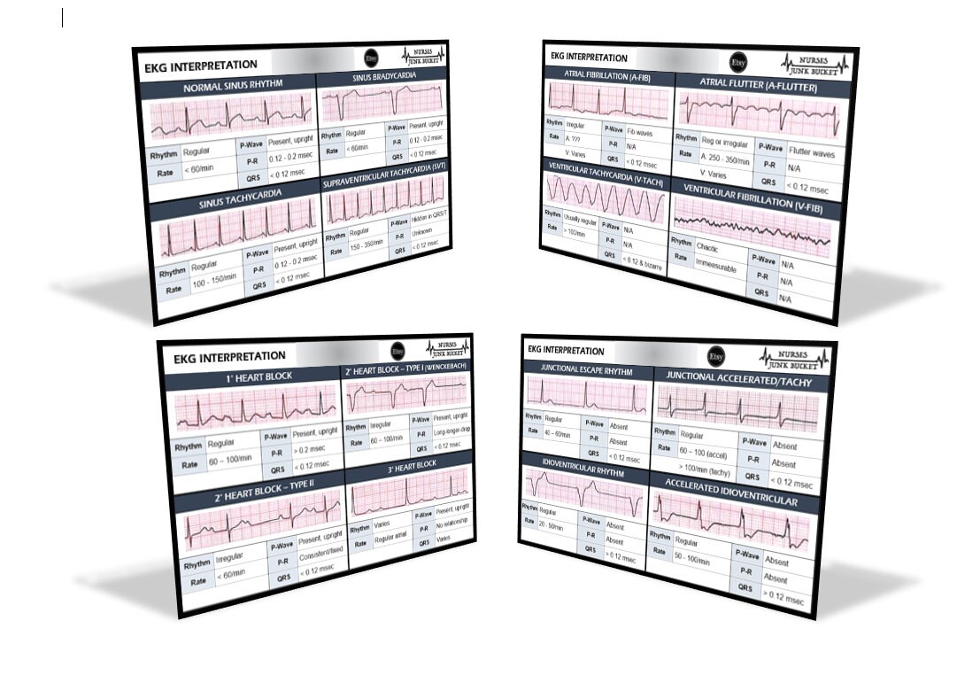 Badge Buddy EKG Interpretation - Etsy
