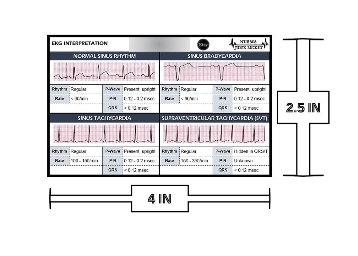 Badge Buddy EKG Interpretation - Etsy