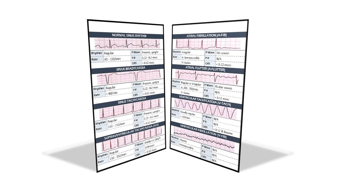 EKG Interpretation Digital Download Badge Buddy - Etsy