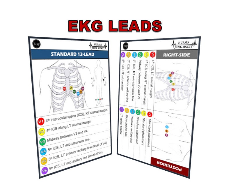 EKG Leads Digital Download Badge Buddy - Etsy