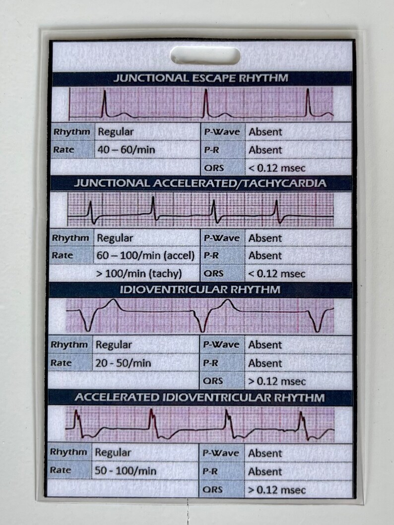EKG Interpretation Digital Download Badge Buddy - Etsy