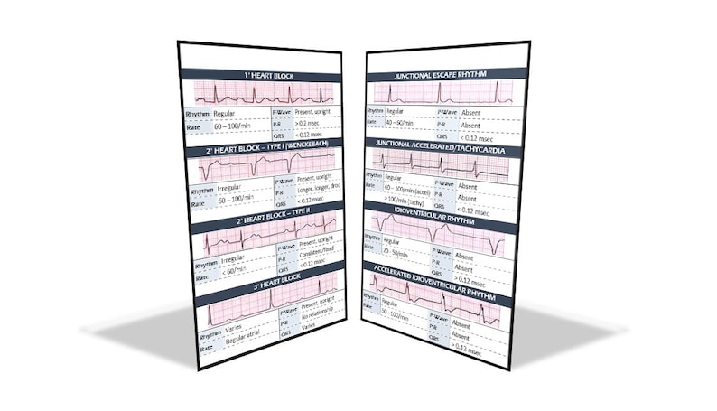 Badge Buddy EKG Interpretation - Etsy