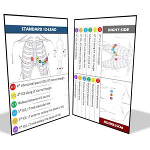 EKG Leads Digital Download Badge Buddy - Etsy