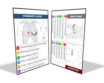 12 Lead Ecg Placement Mnemonic