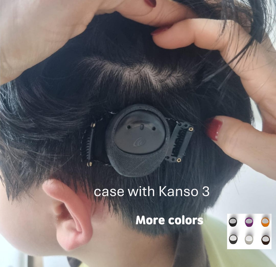 Cochlear Kanso 2 and 3 Case With Wig Clips: Anti-loss TPU Cover - Etsy