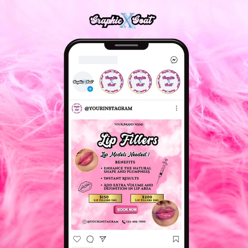 Lip Fillers Flyer Template, Botox Fillers Instagram Post, Templates Lip ...