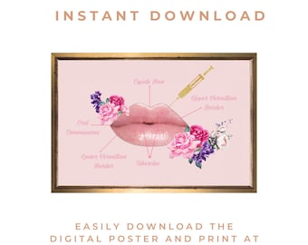 Lip Anatomy Arts Poster, Lip Filler, Aesthetic Poster, Lip Filler ...