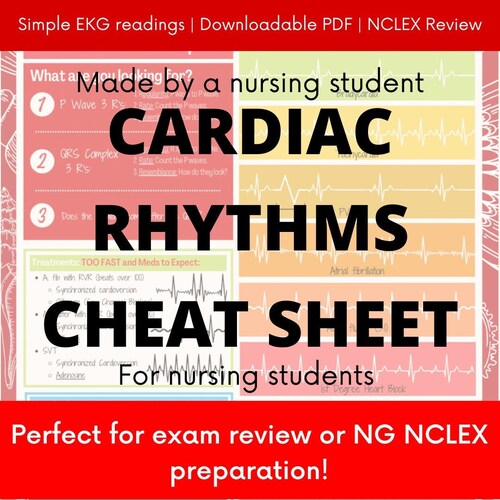 Cardiac Rhythms Cheat Sheet PDF Made for Nursing Students BY - Etsy