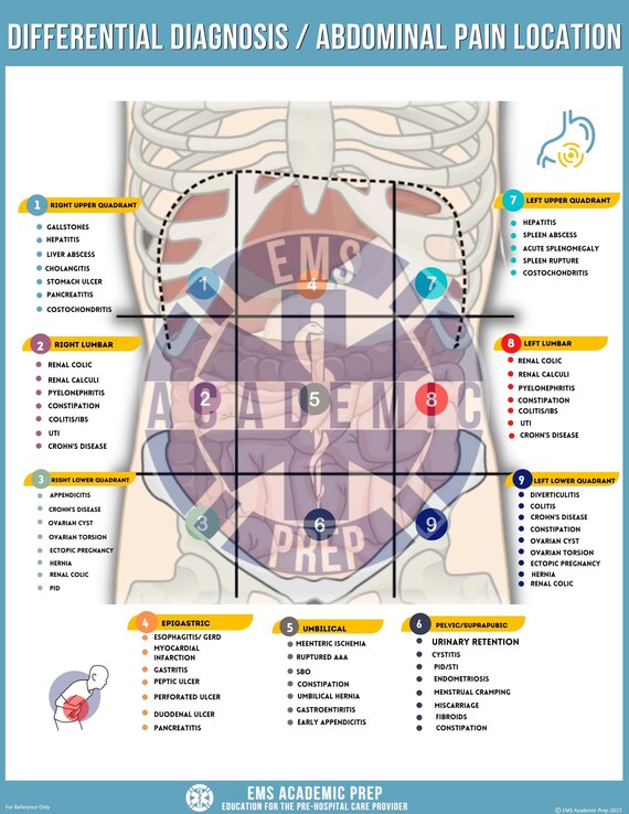 Abdominal Regions Quiz