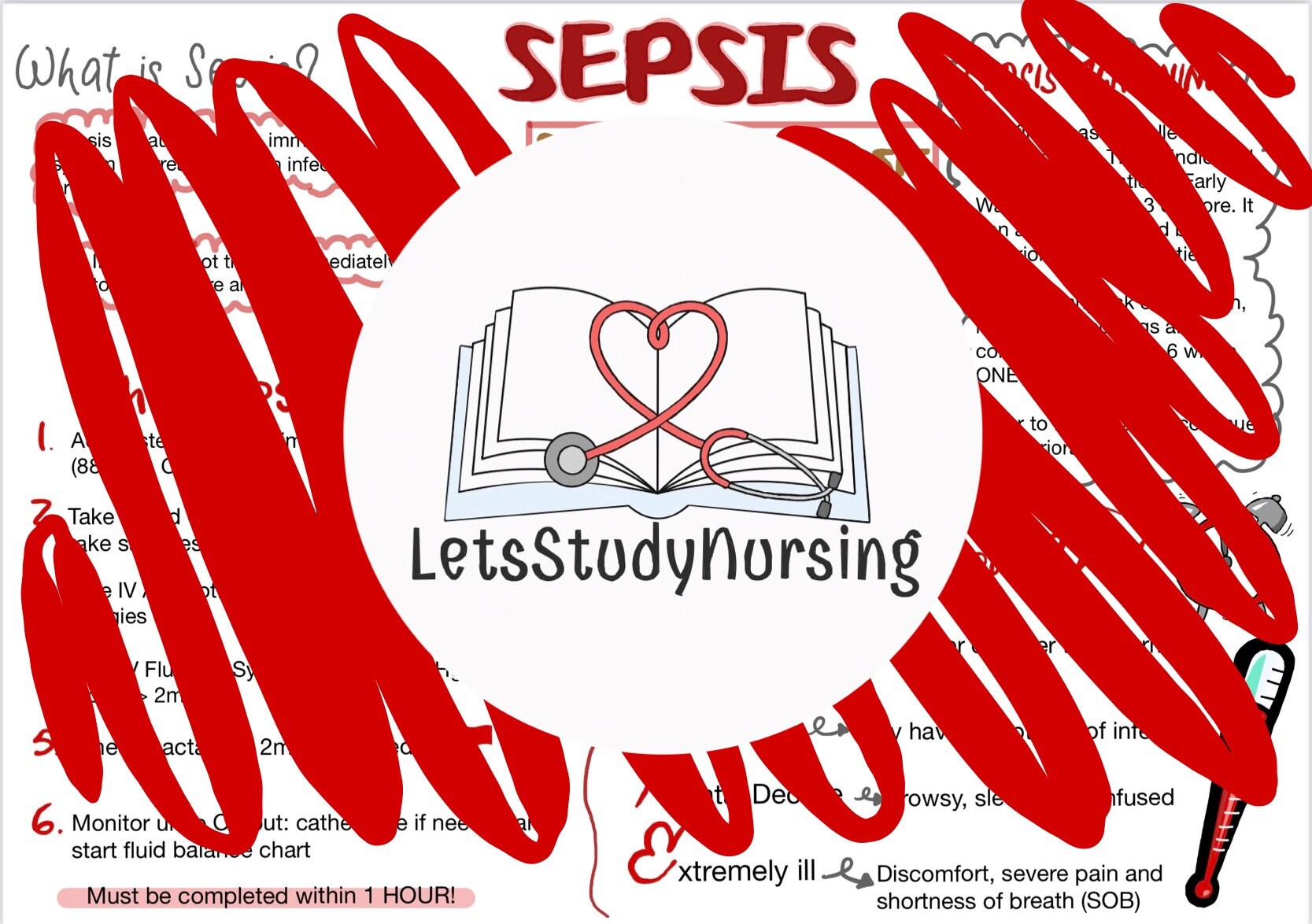 Sepsis Revision Poster PDF - Etsy UK