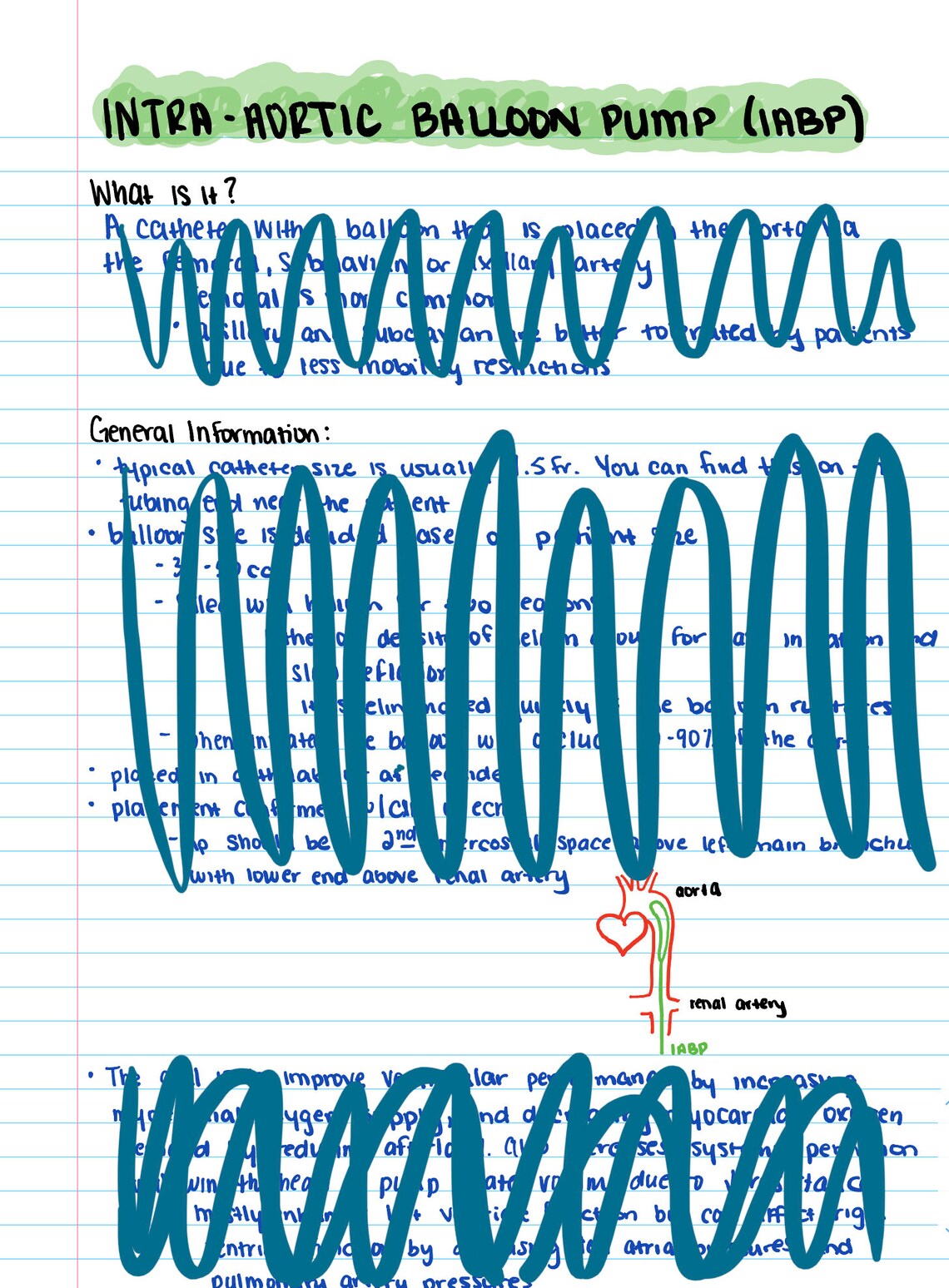 Intra-aortic Balloon Pump Notes - Etsy