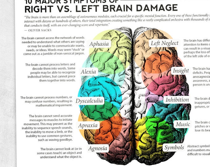Printable Resource 10 Major Symptoms of Left Vs. Right Brain Damage - Etsy