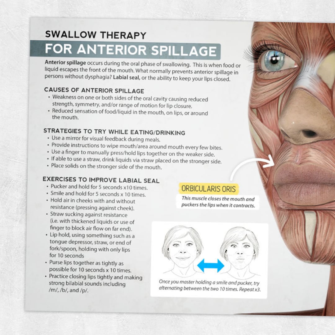 Printable Resource Swallow Therapy for Anterior Spillage - Etsy