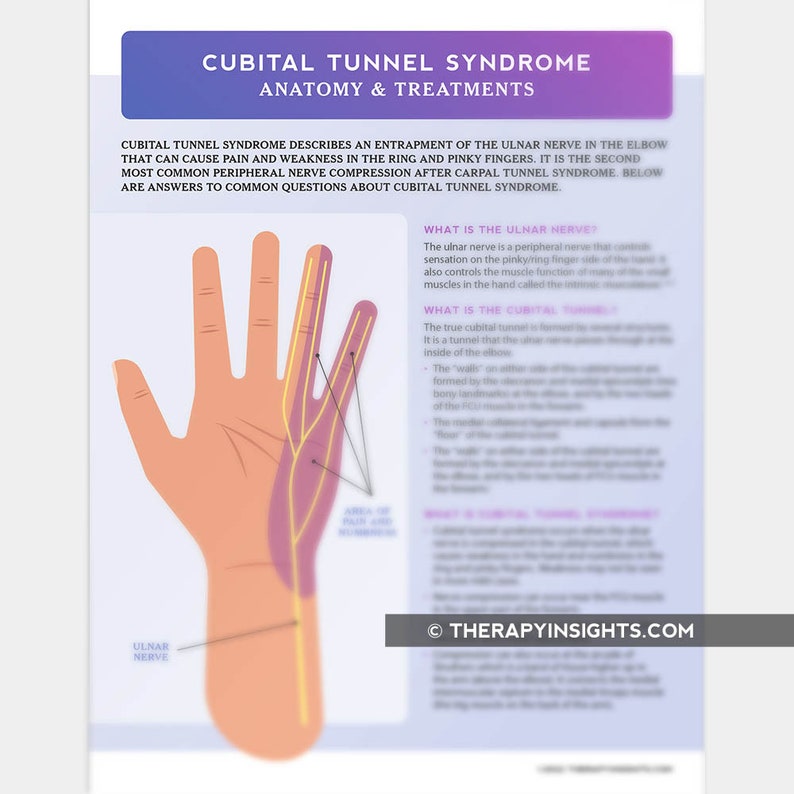 Cubital Tunnel Syndrome: Anatomy and Treatment - Etsy